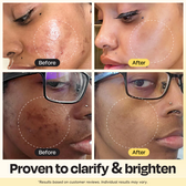 Gleam Dream Team: Complete Skincare Set for Radiant Skin
