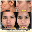 Gleam Dream Team: Complete Skincare Set for Radiant Skin