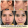 Gleam Dream Team: Complete Skincare Set for Radiant Skin
