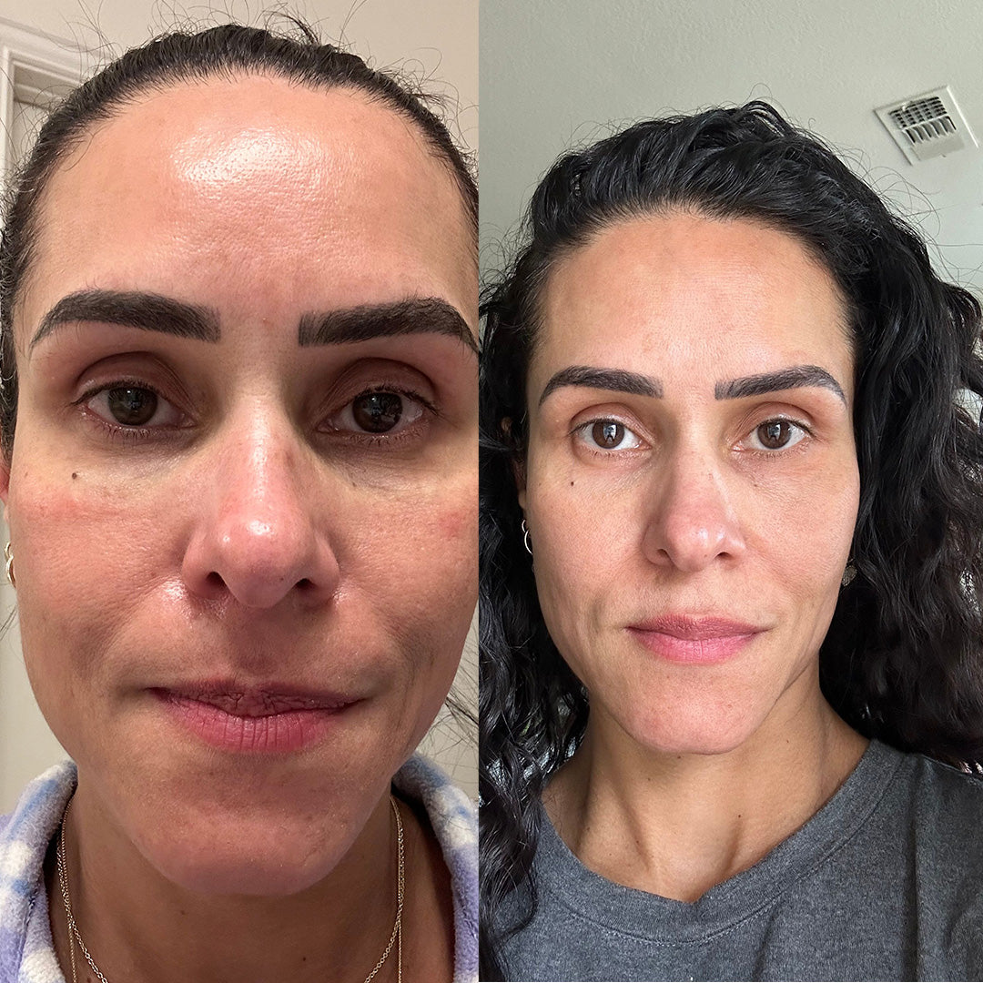 See Real Before & After Results | Gleamin