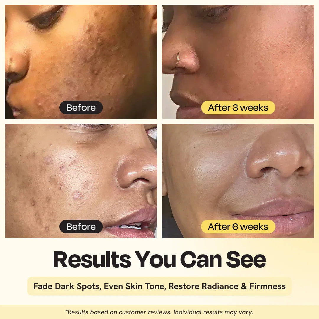 Gleam Dream Team: Complete Skincare Set for Radiant Skin